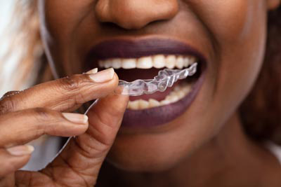 Invisalign® Clear Braces in Sparks, NV - Kanellis Family Dentistry